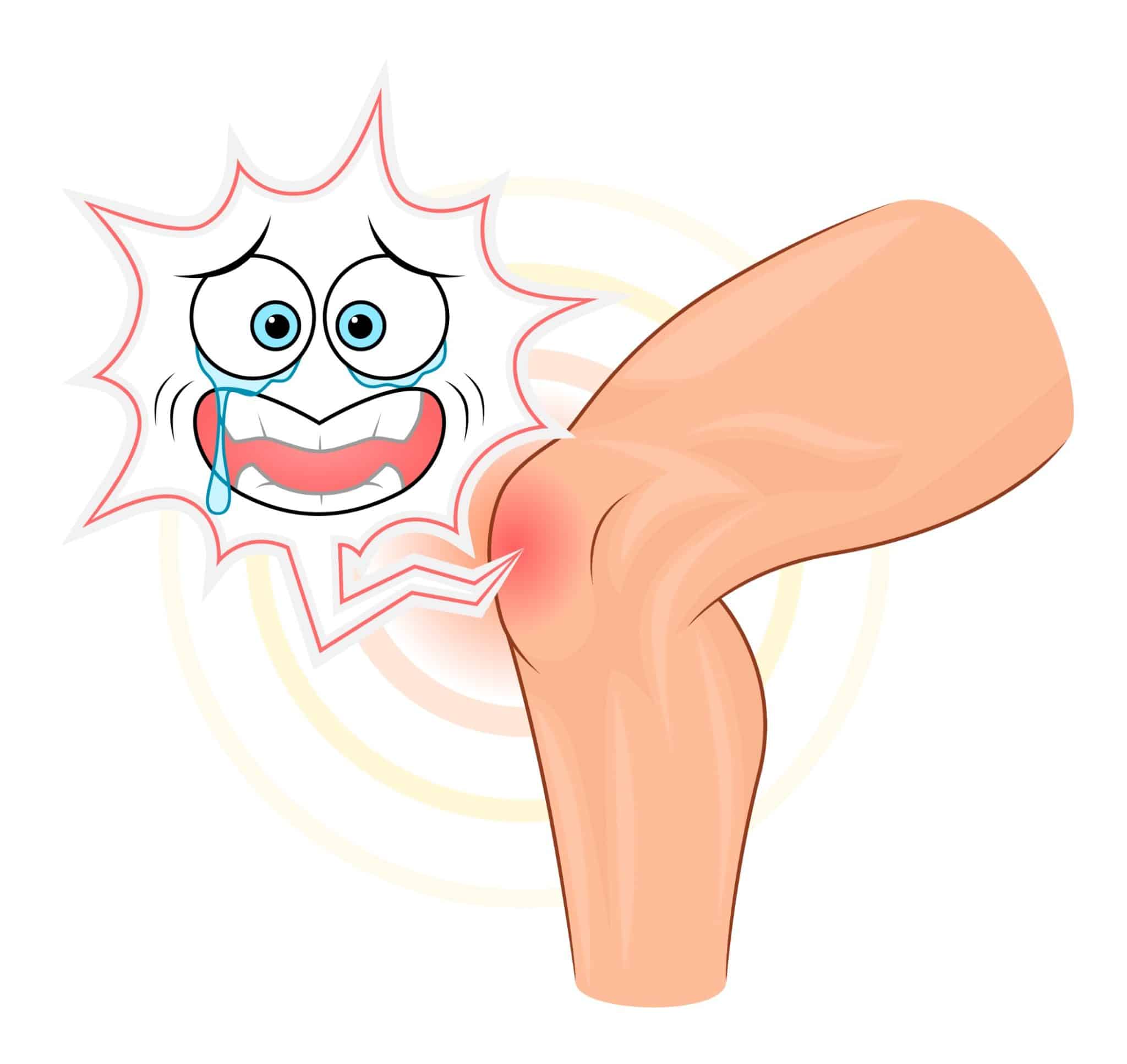 Douleur sur la rotule : causes et traitements